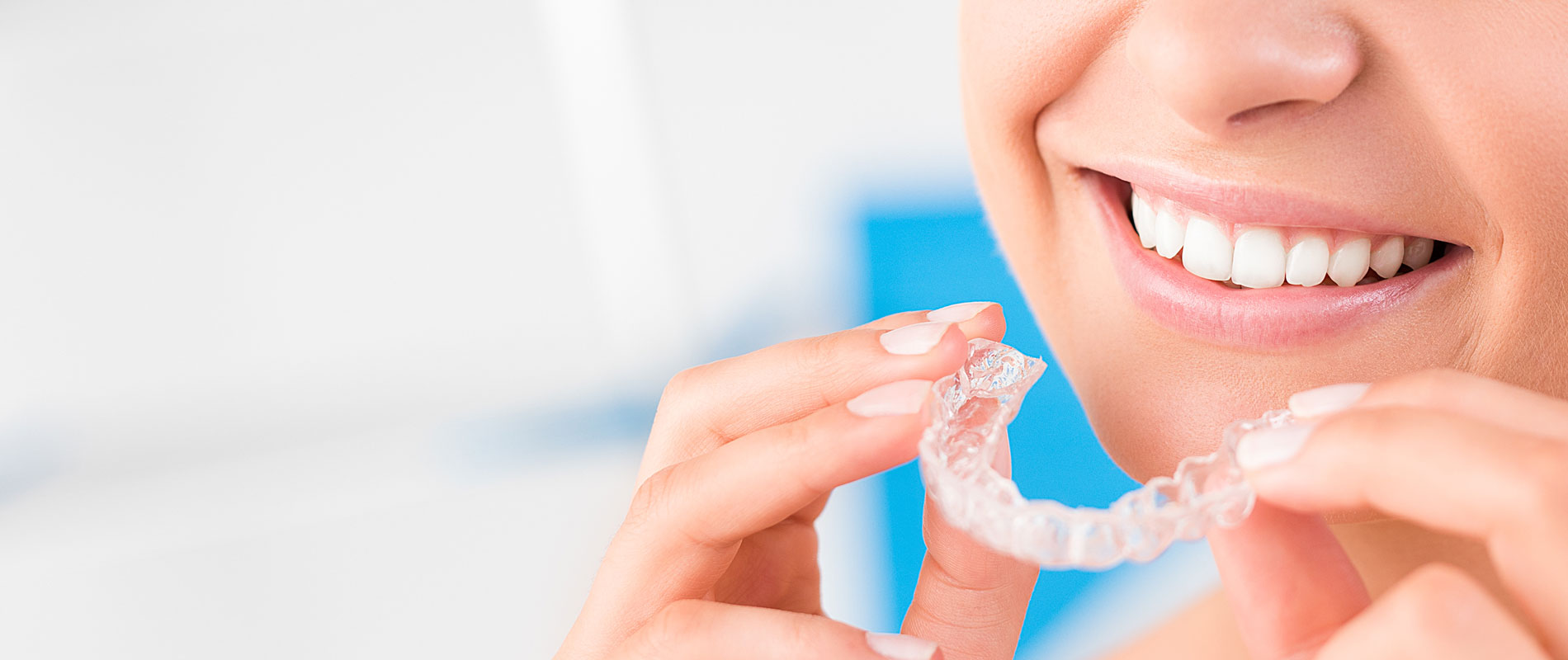 Aligner Zahnspange Spark™ Clear Aligner System, Erwachsene